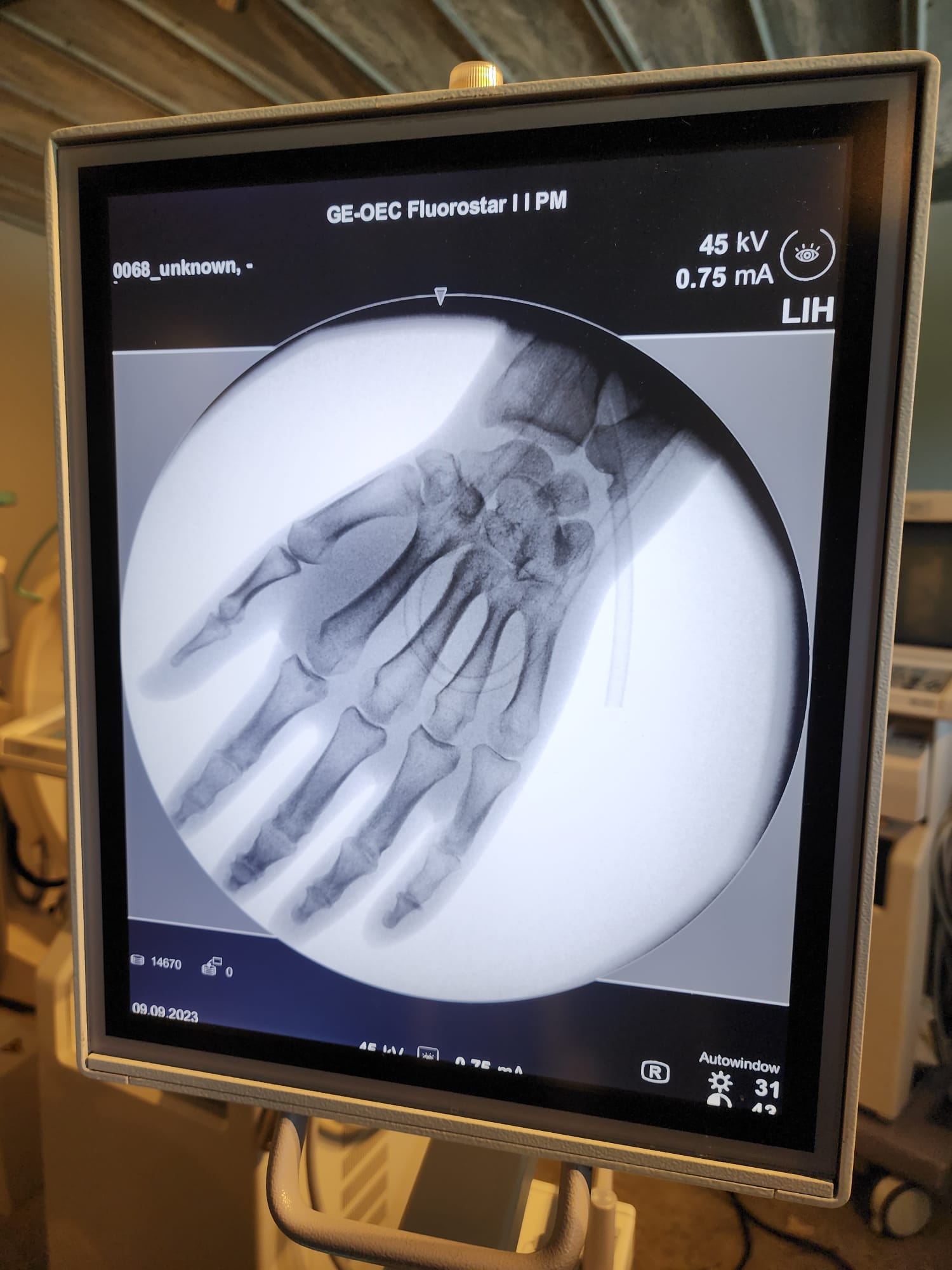 GE OEC FLUOROSTAR Compact C-ARM – inCAV Medical And Laboratory Equipment