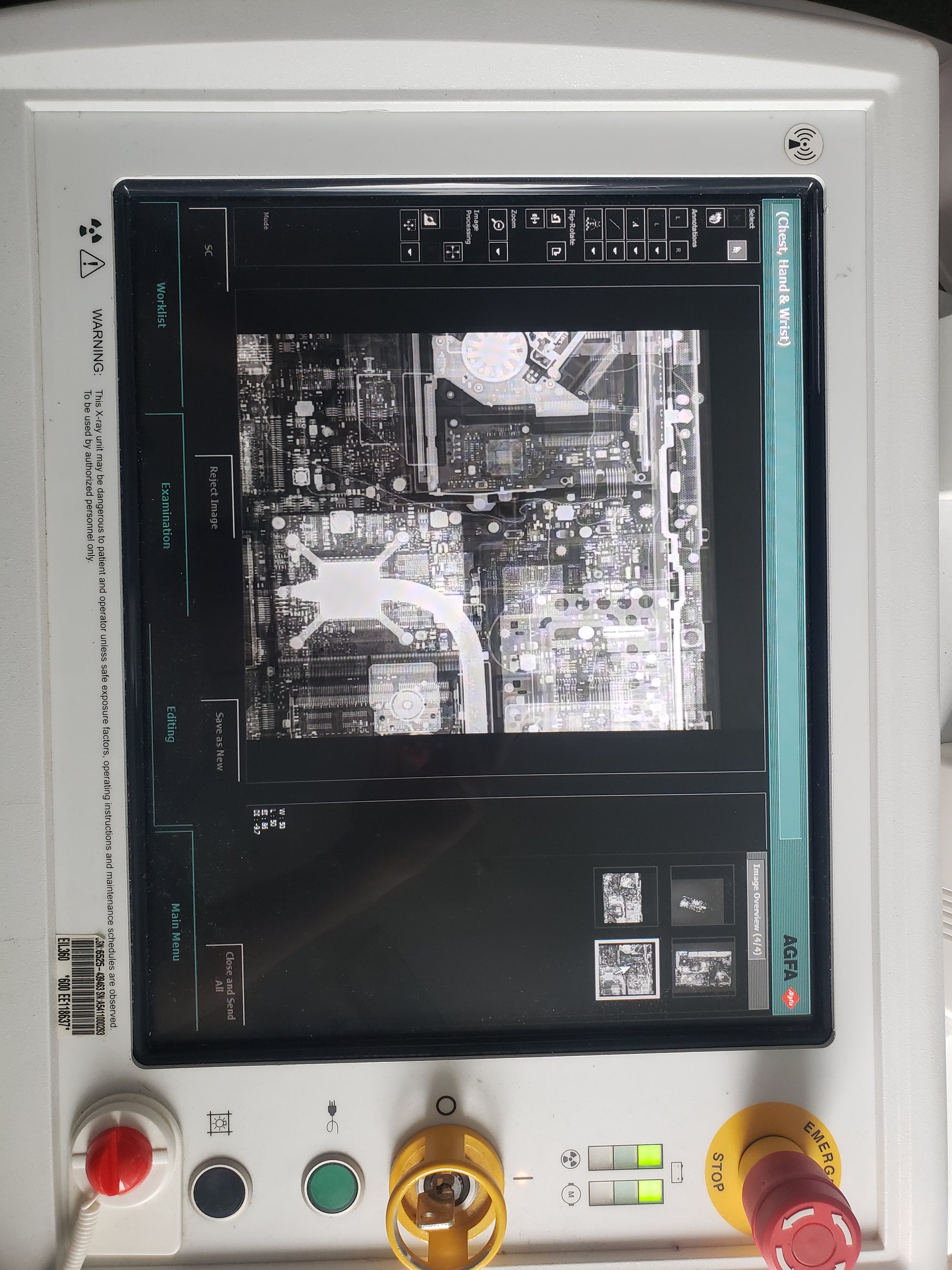 AGFA DX-D100 DIGITAL DR PORTABLE X-RAY with WIRELESS Flat Panel Detect ...